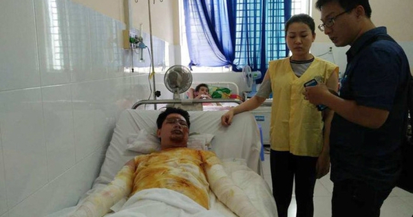 Nắp bình xăng xe môtô 1.000 phân khối bật tung, lái xe bỏng nặng | Tạp ...